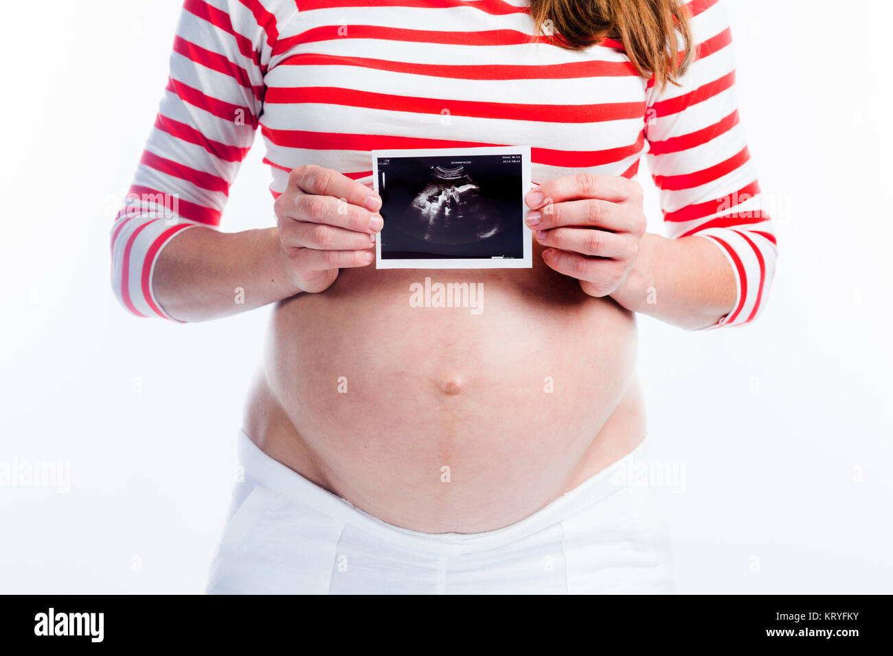 Schwangere Frau mit Ultraschallbild - pregnant woman with ultrasonogram ...