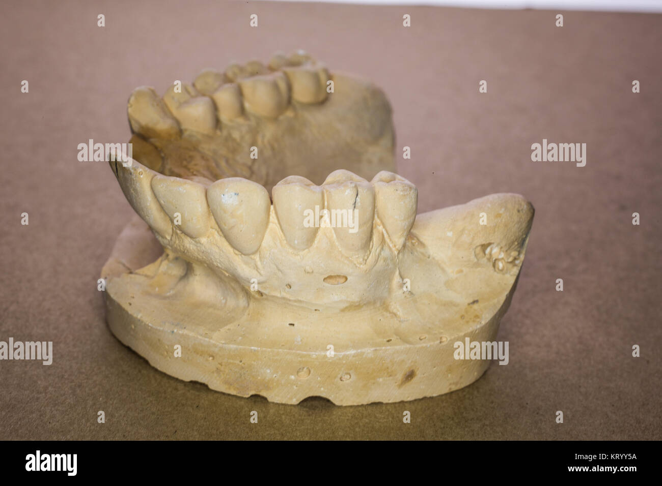 Maxillary teeth hi-res stock photography and images - Alamy