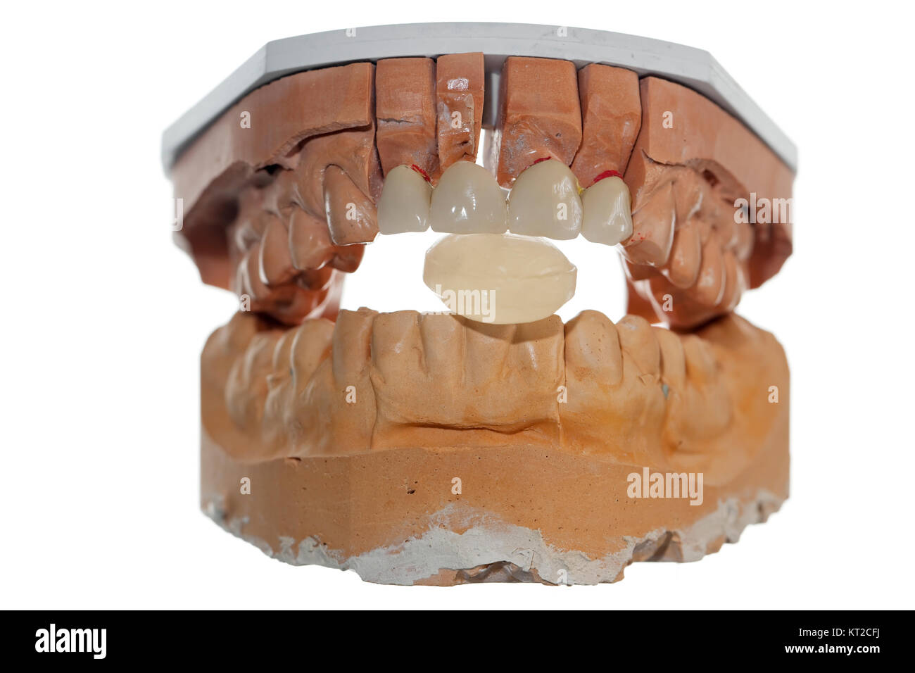 Candy can cause teeth to decay Stock Photo - Alamy