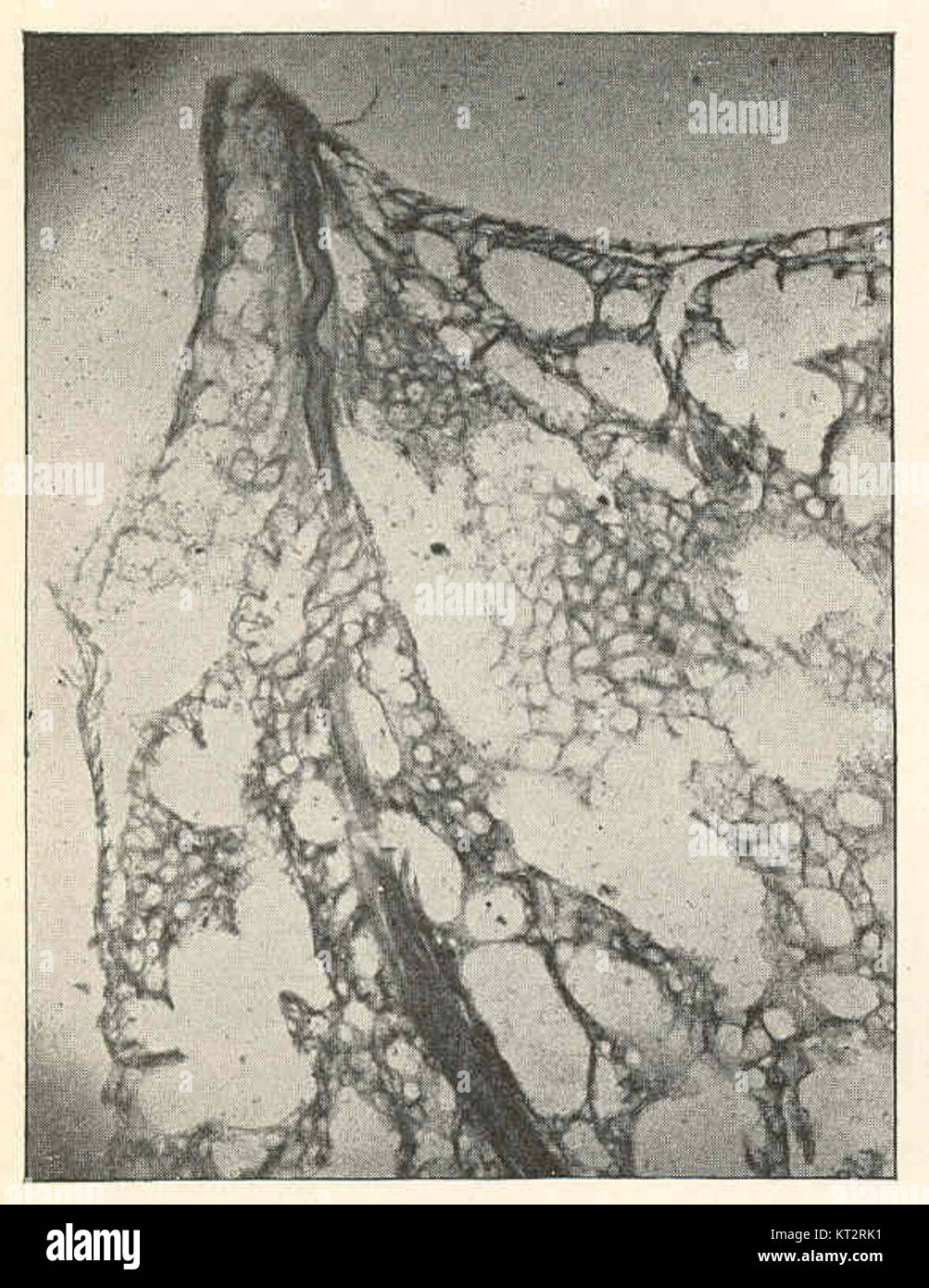 38341 Aplysilla longispina Section vertical to the surface and through ...