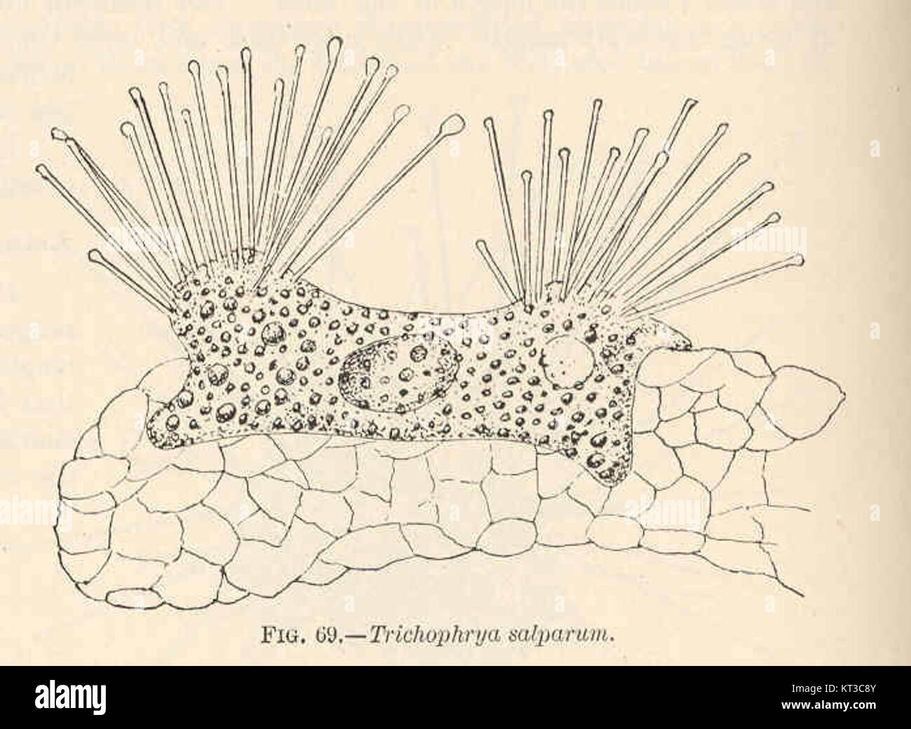 A scientific image of Trichophrya salparum, a type of ciliated ...