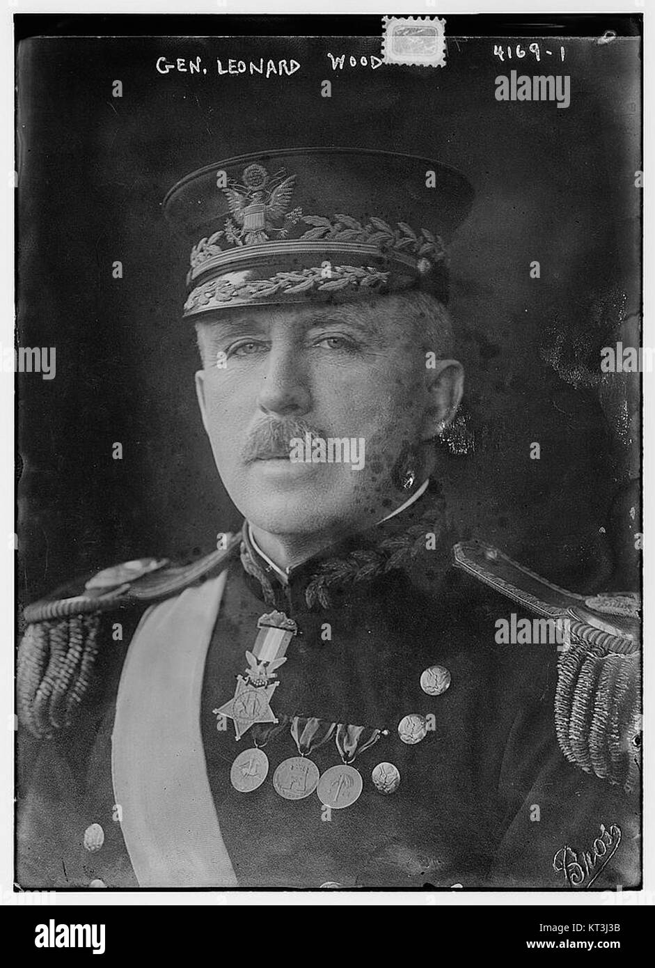 General Leonard Wood was an American military officer, physician, and ...
