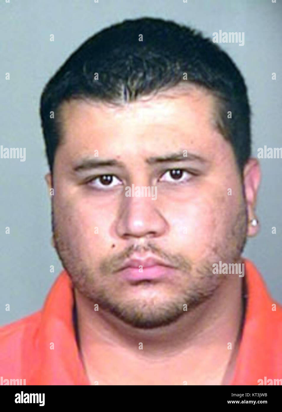 George Zimmerman Wounds