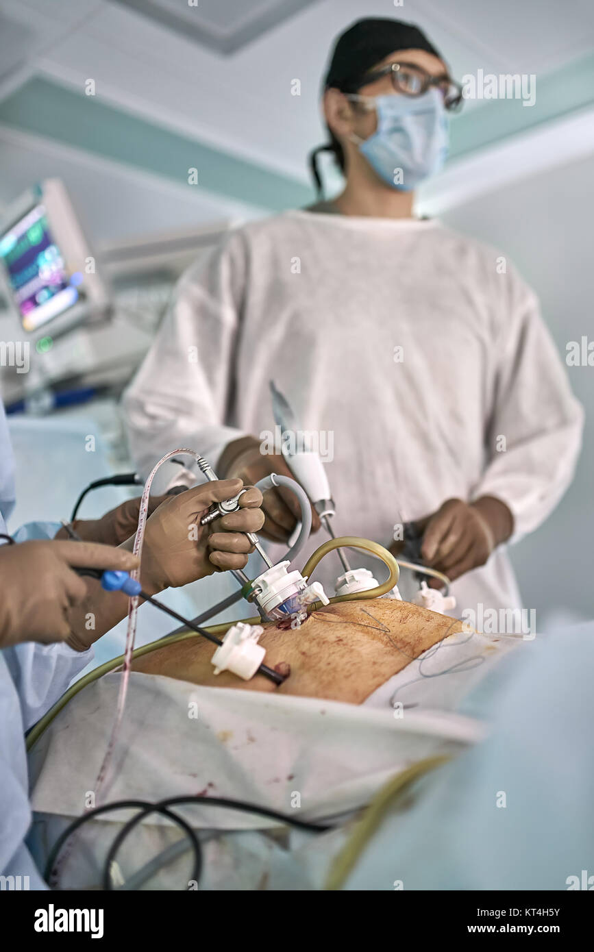 Laparoscopy operation process Stock Photo - Alamy