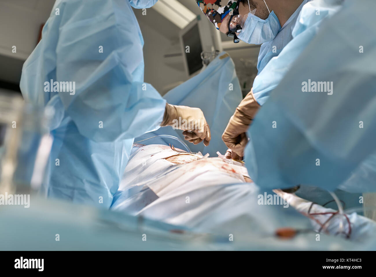 Abdominal operation process Stock Photo - Alamy