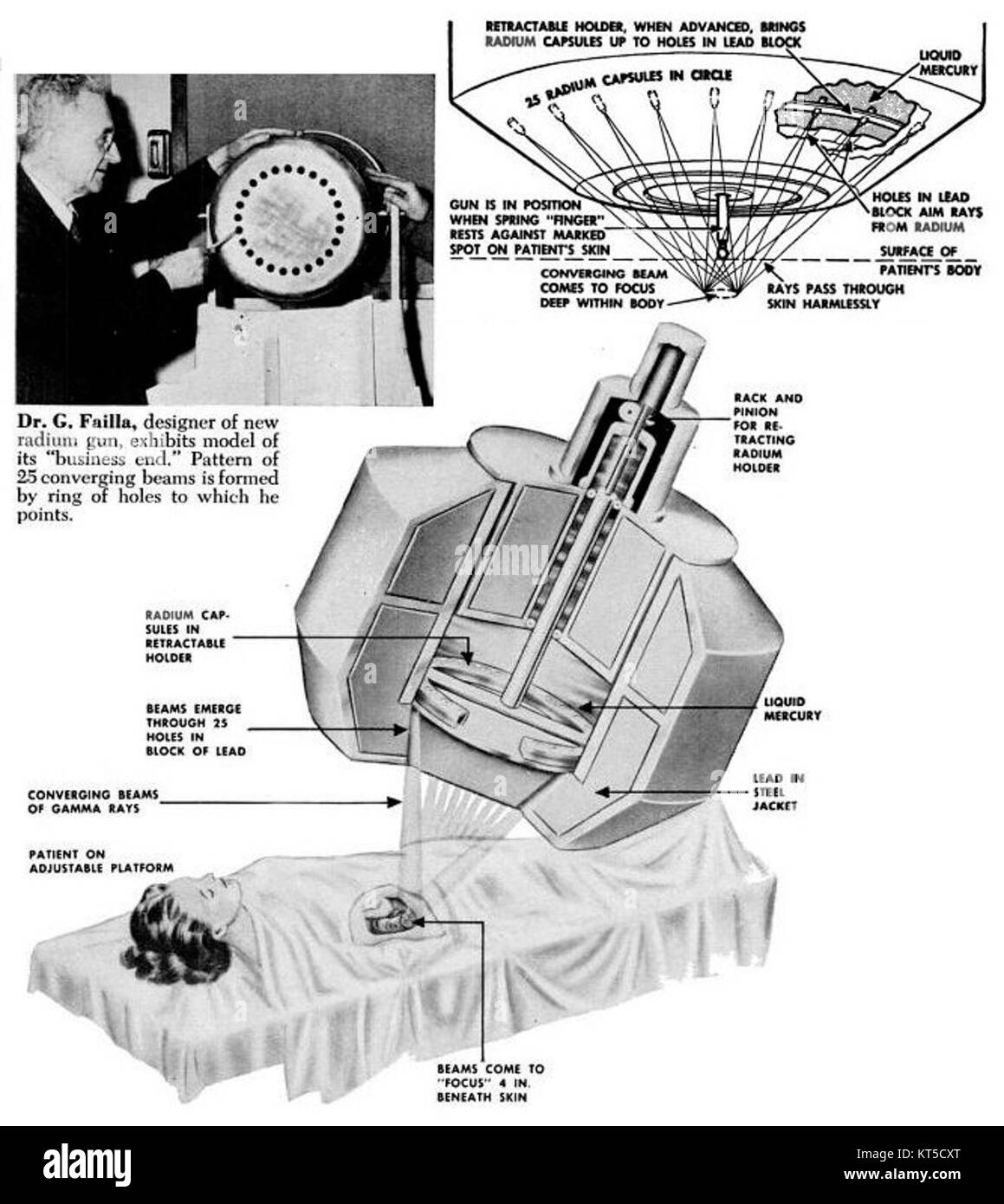 Radiotherapy history Black and White Stock Photos & Images - Alamy
