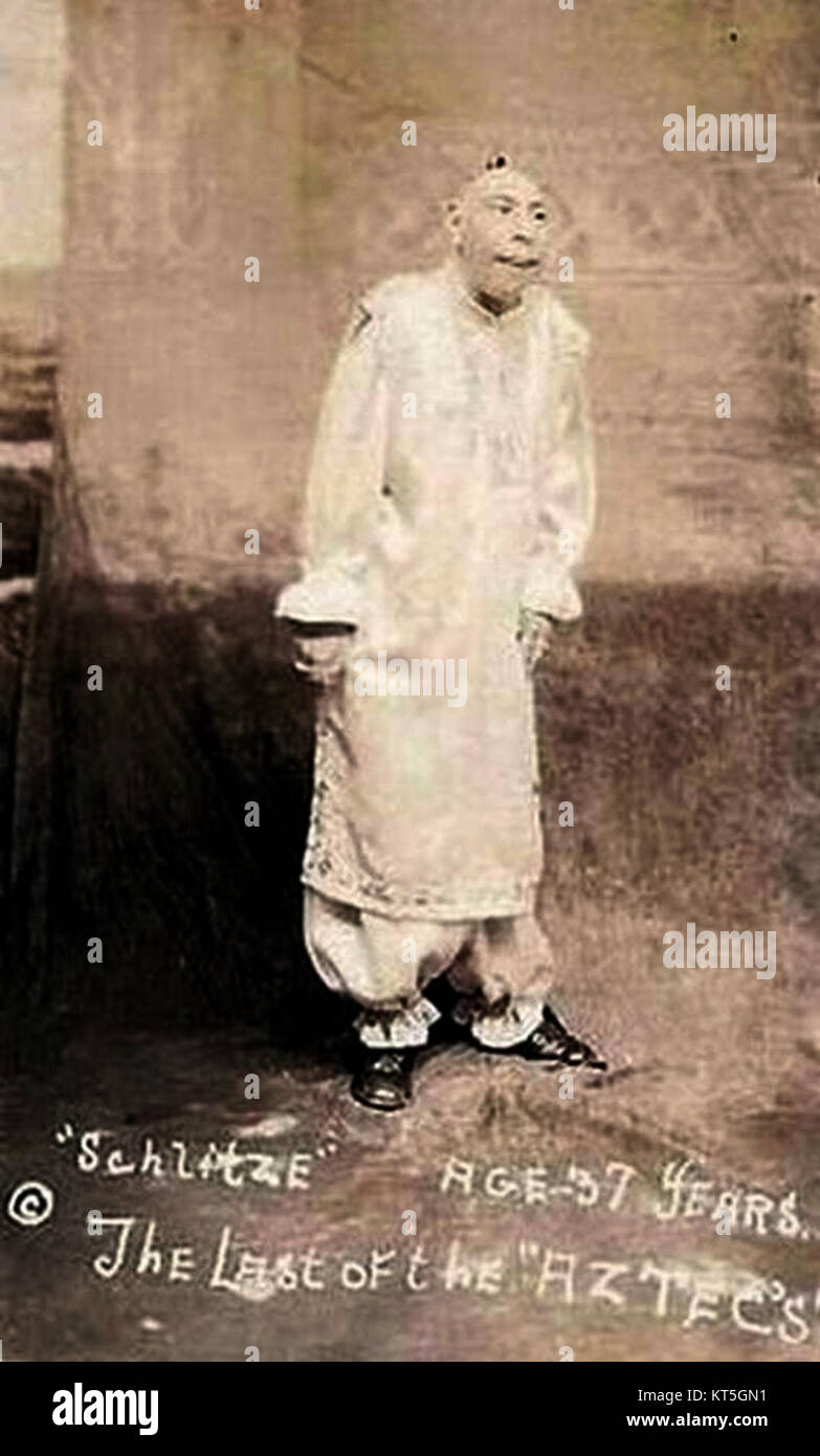 Schlitzie hi-res stock photography and images - Alamy