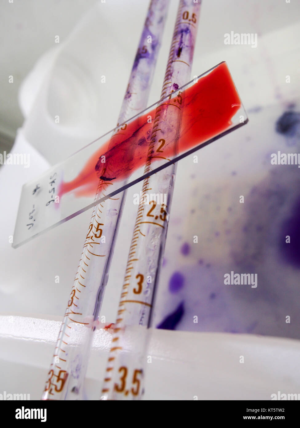 Microscope slide with red strain Stock Photo - Alamy