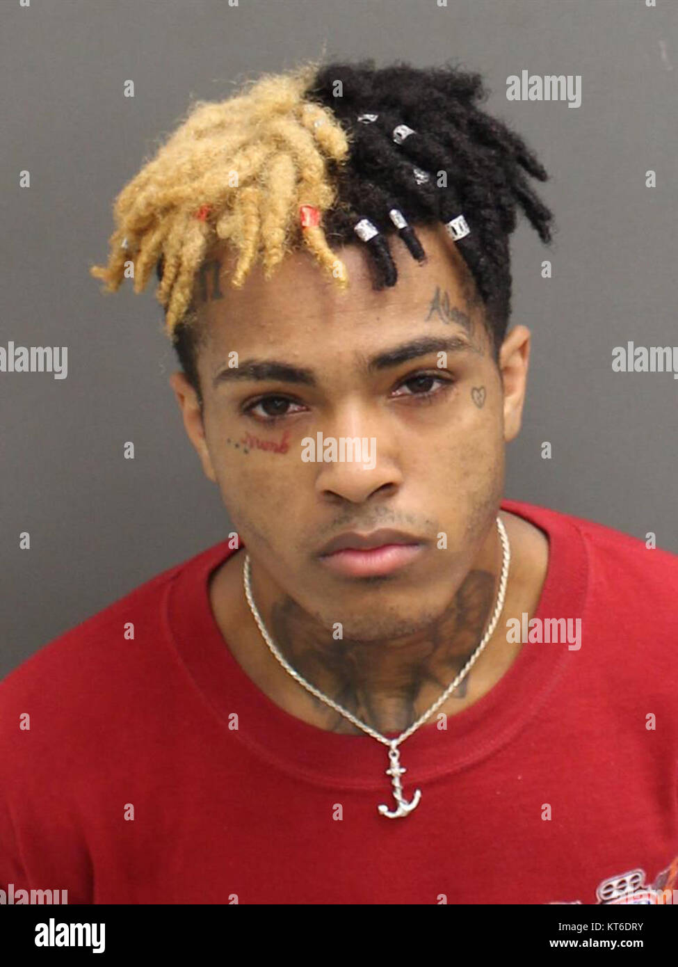 The X-Mugshot is a photographic representation, often associated with ...