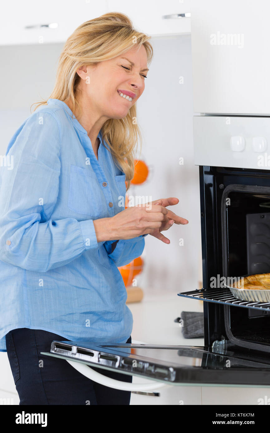 kitchen burn on hand caused by heating oven Stock Photo - Alamy