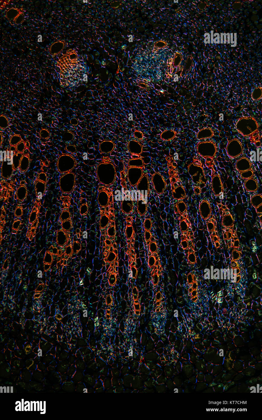Cross section bone hi-res stock photography and images - Alamy