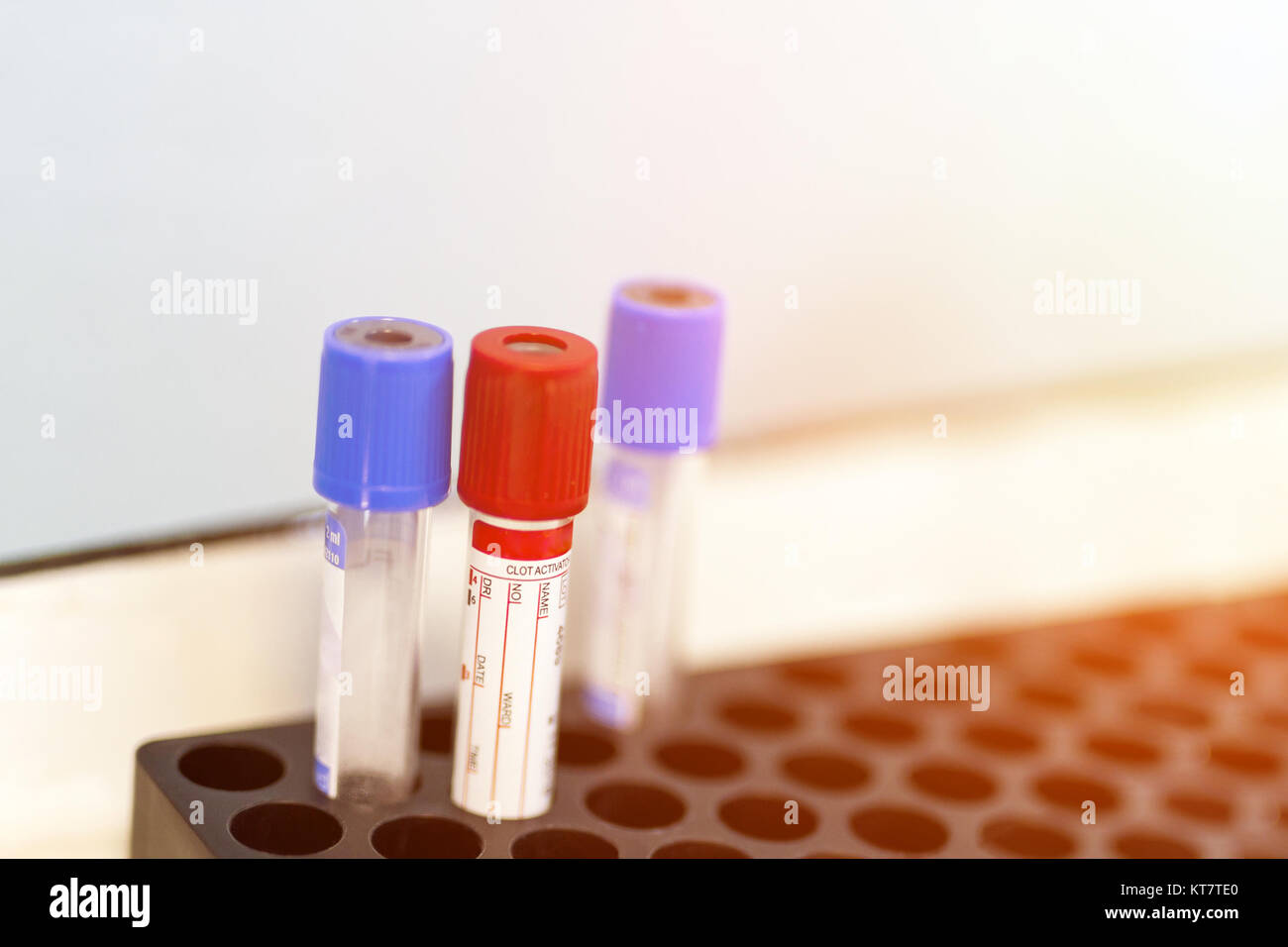 Lot of empty laboratory blood analysis tubes at medical center Stock ...