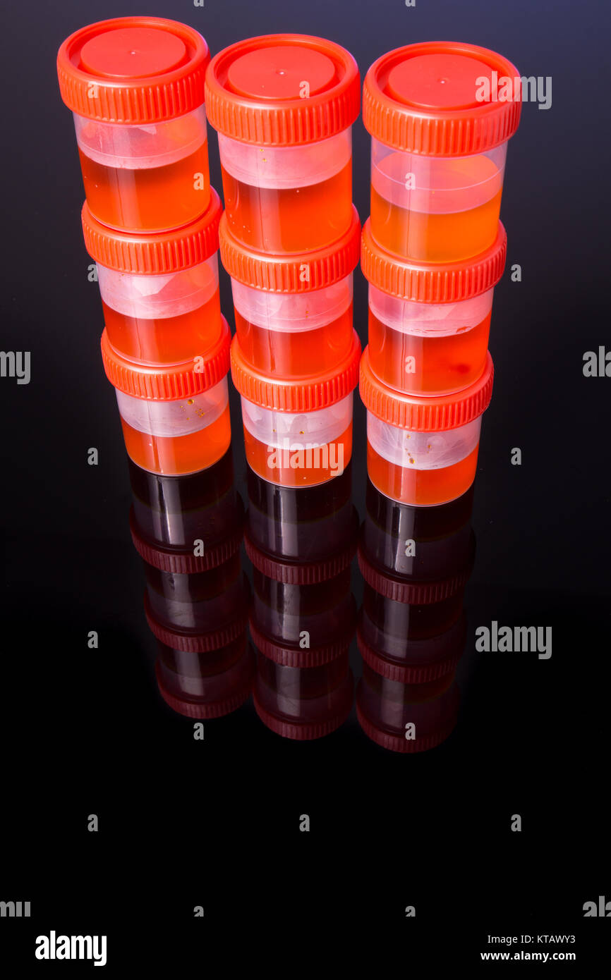 pile of urine sample tube Stock Photo - Alamy