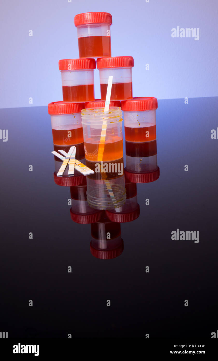 Pile of urine sample tube isolated on a shiny black blue background ...