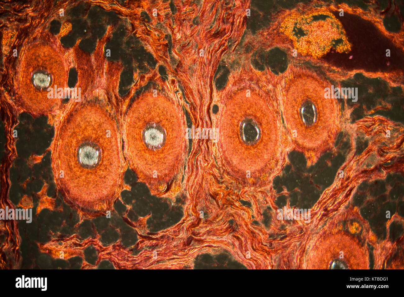 scalp with hair roots 100x Stock Photo - Alamy