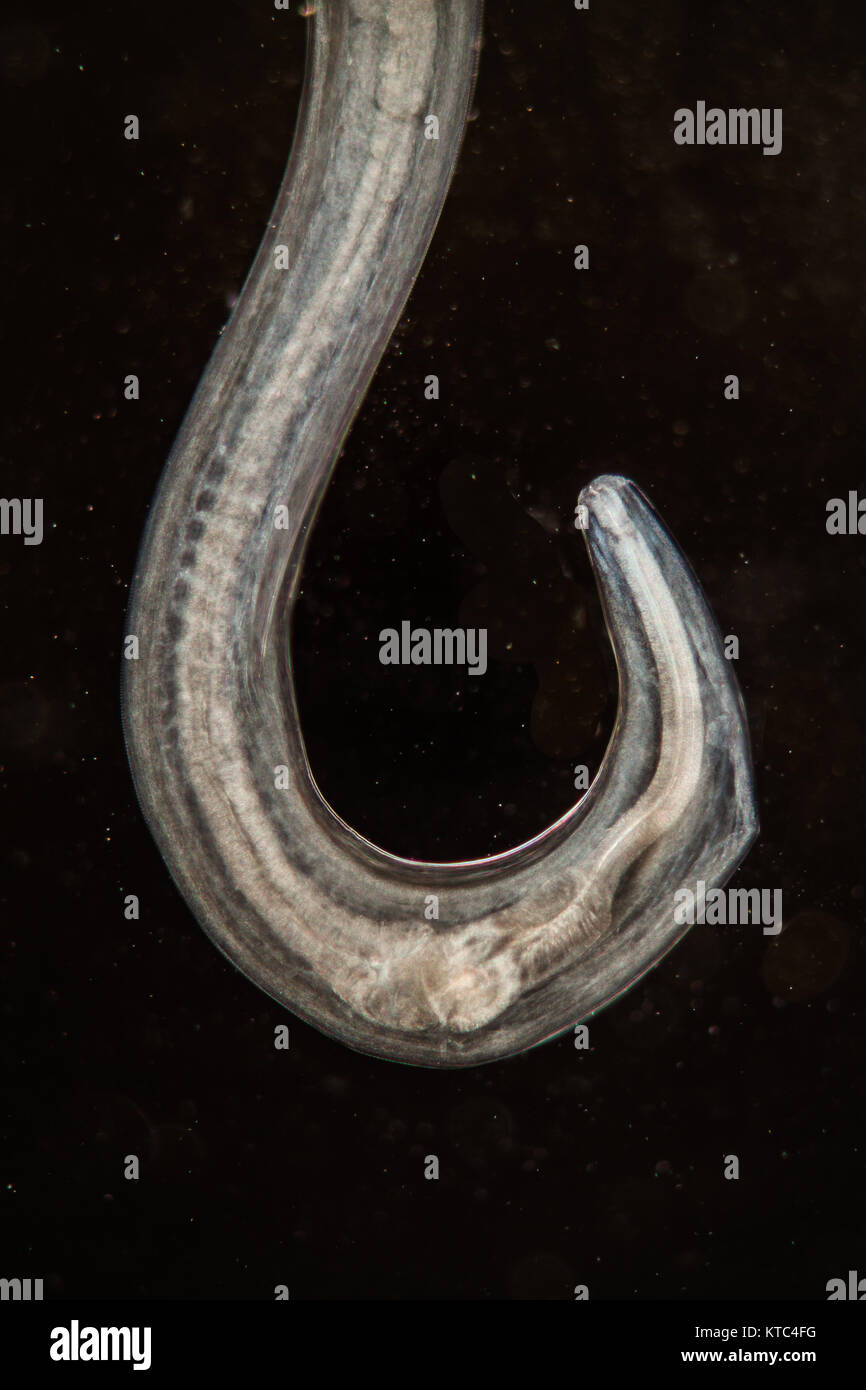 hookworm parasite 100x Stock Photo - Alamy