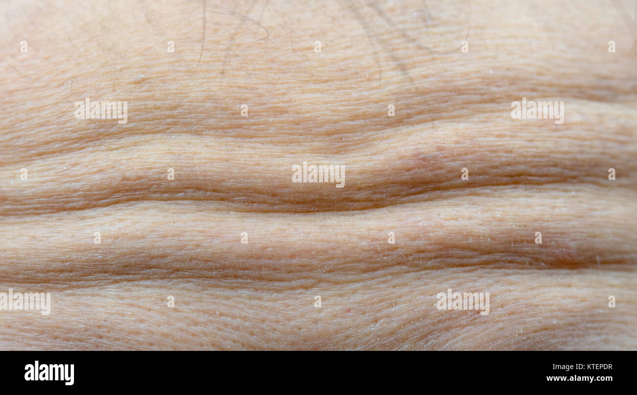 Macro shot detail of forehead wrinkles from emotional expression ...