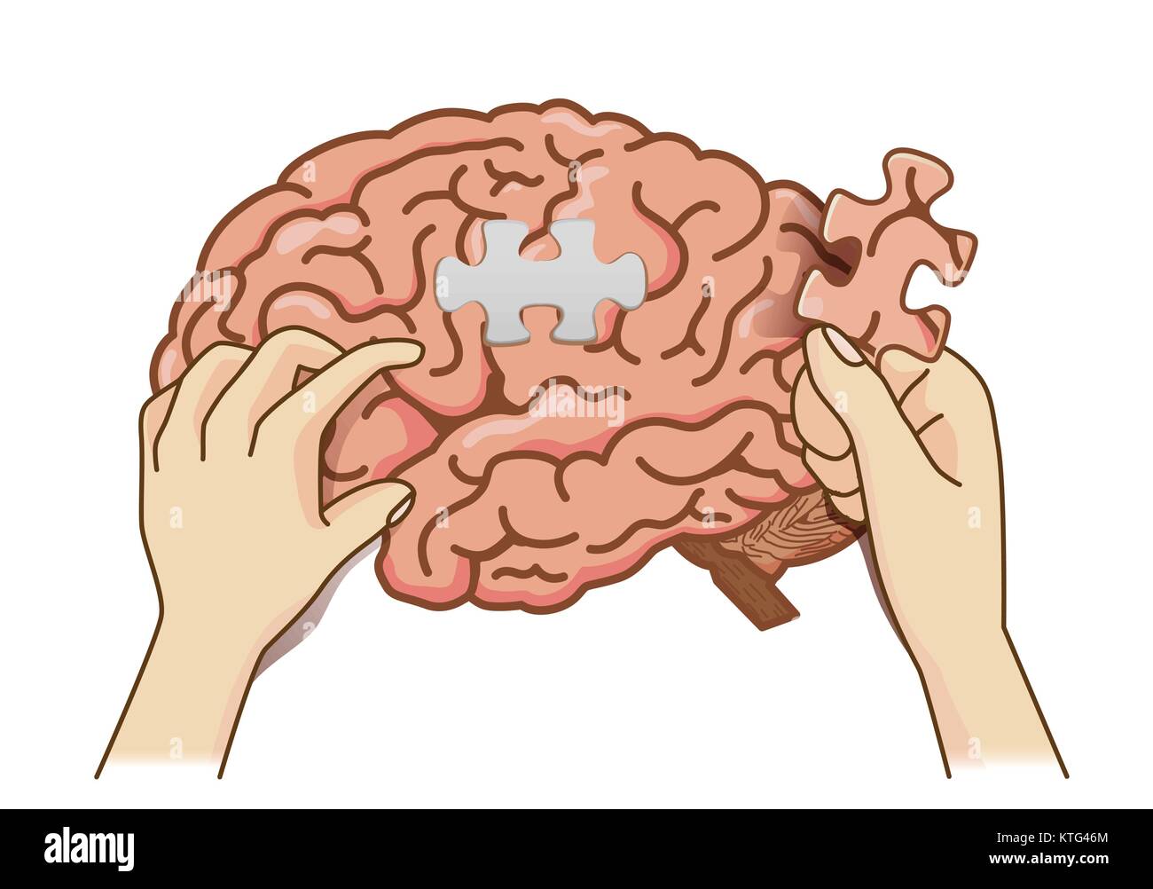 Cartoon brain surgery hi-res stock photography and images - Alamy
