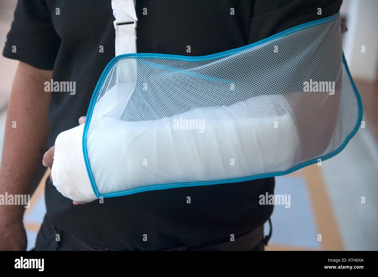 Man with a plaster because broken arm Stock Photo - Alamy