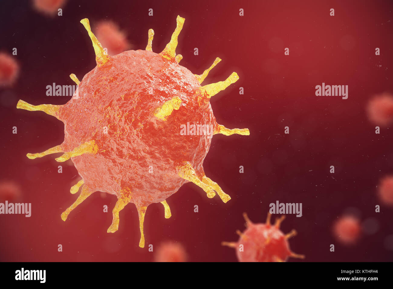 Viral hepatitis infection causing chronic liver disease , Hepatitis ...