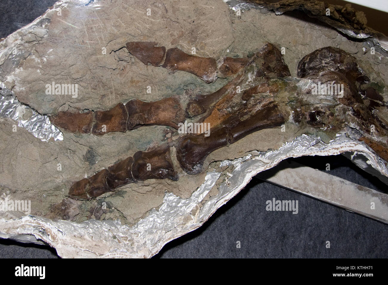 Right foot bones hi-res stock photography and images - Alamy
