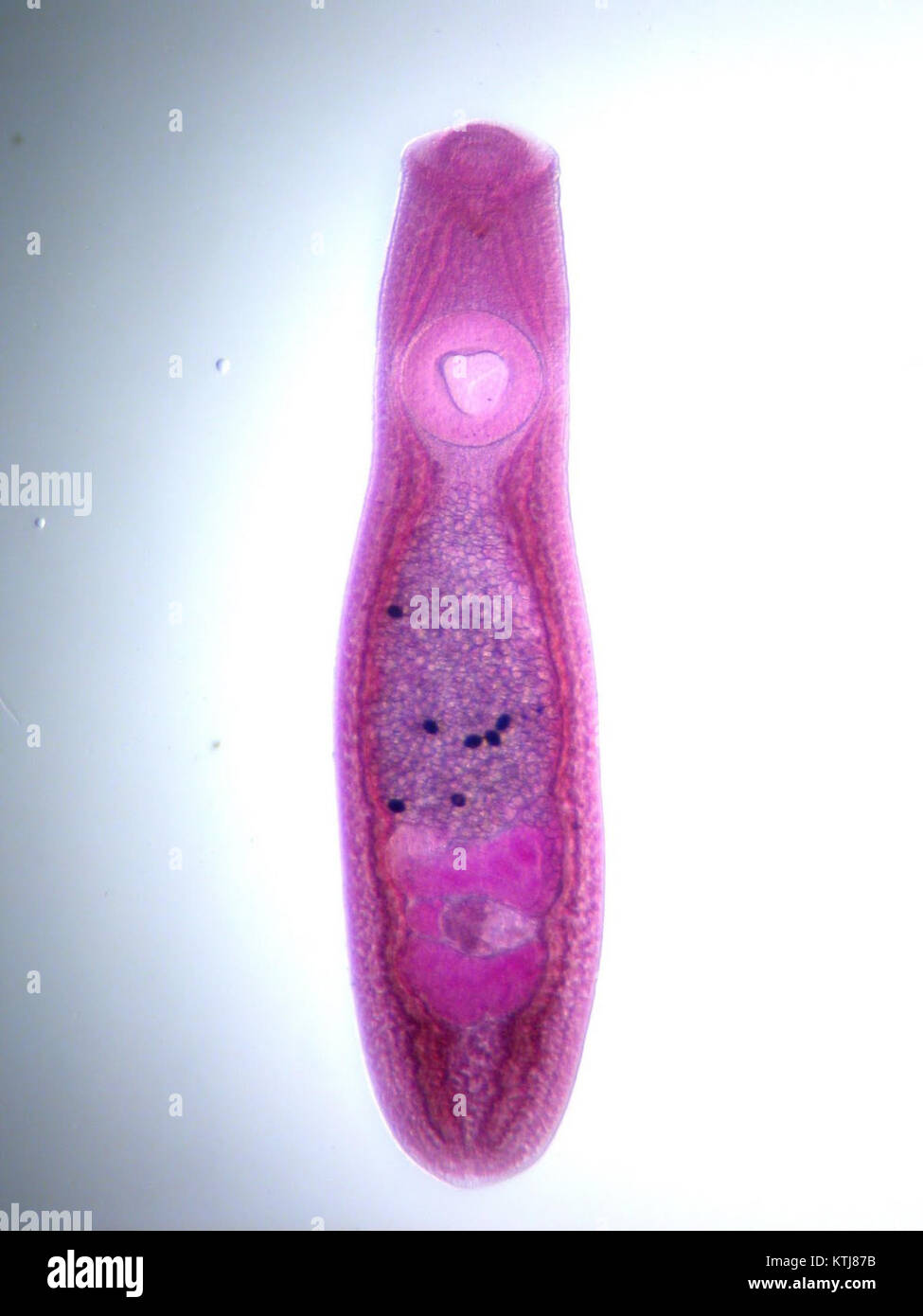 Clinostomum is a parasitic genus affecting certain fish species. This ...