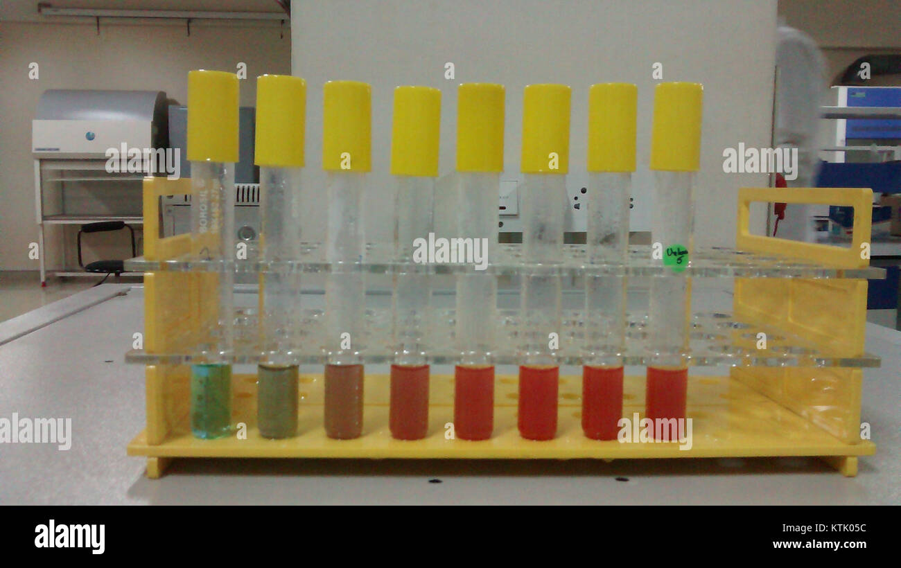 Benedicts test hi-res stock photography and images - Alamy