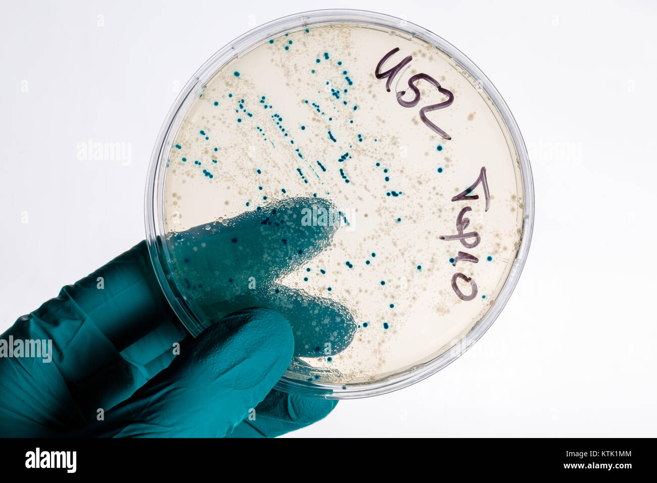 colonies in petri dish for cloning of transgenic vector into plasmid ...