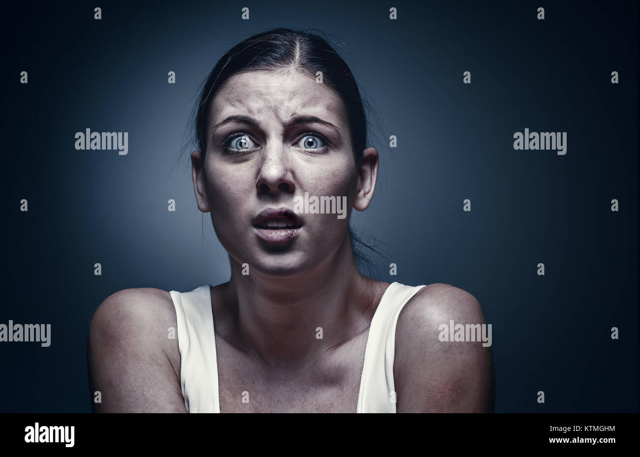 Female bruised face hi-res stock photography and images - Alamy