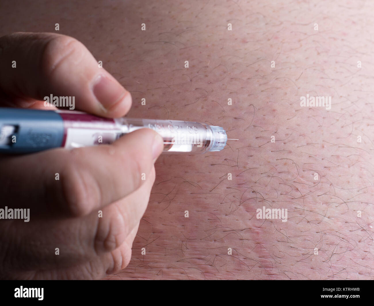 Insulin pen hi-res stock photography and images - Alamy