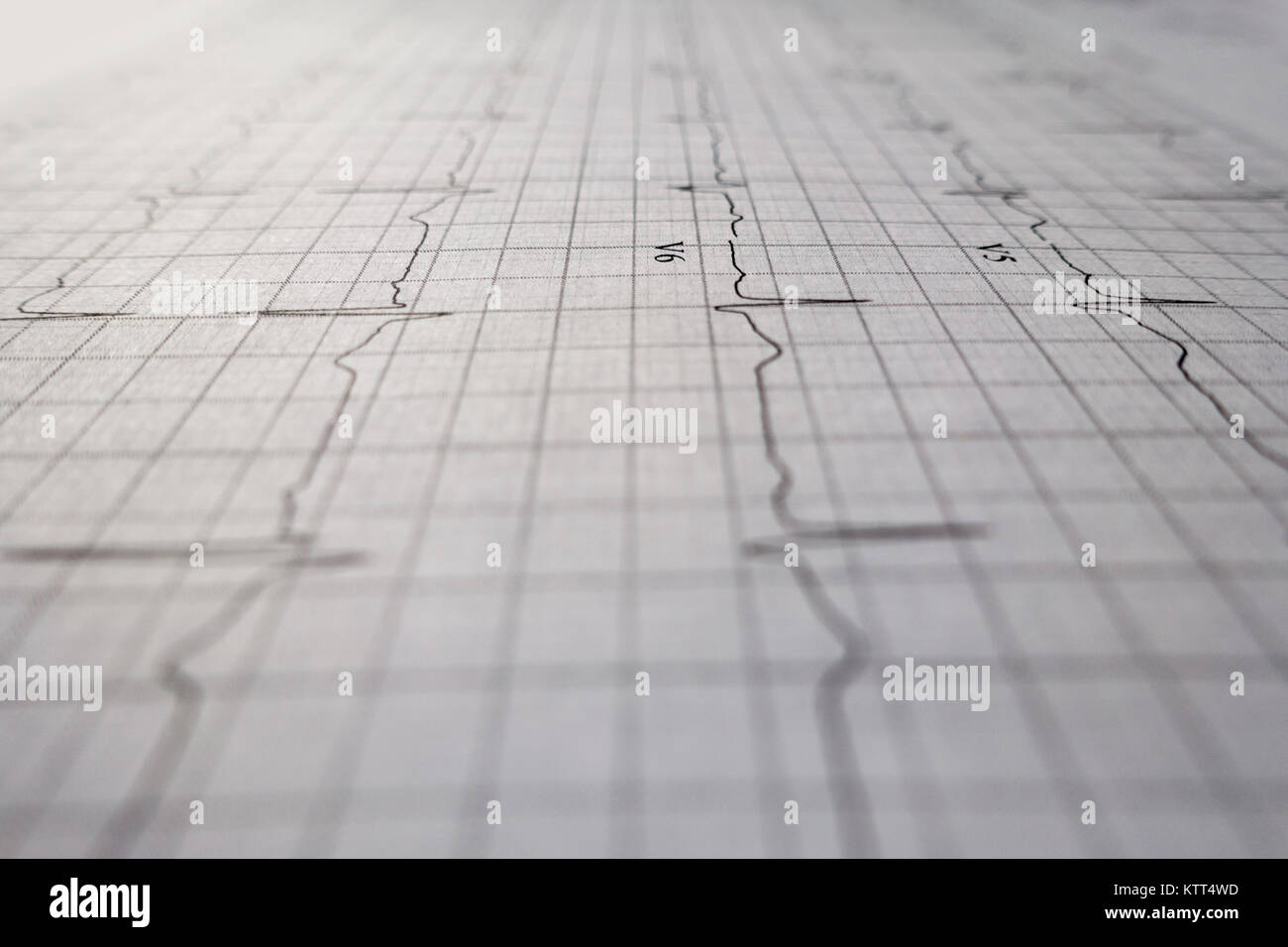 heart test ekg Stock Photo - Alamy