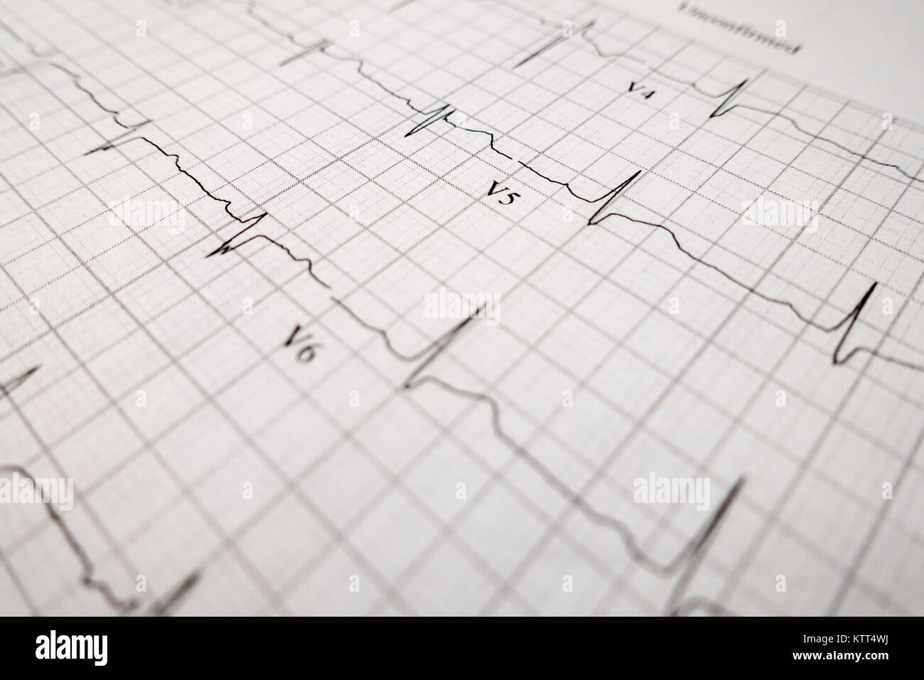 heart test ekg Stock Photo - Alamy