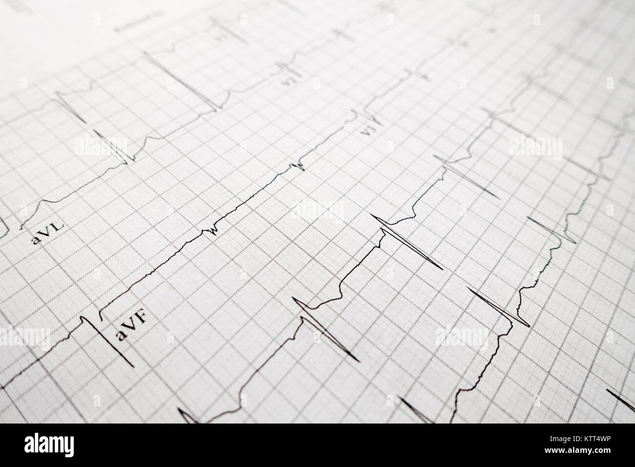 heart test ekg Stock Photo - Alamy