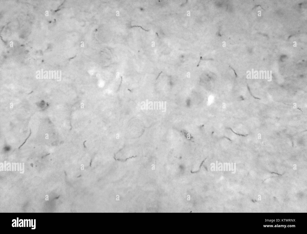 Treponema pallidum hi-res stock photography and images - Alamy