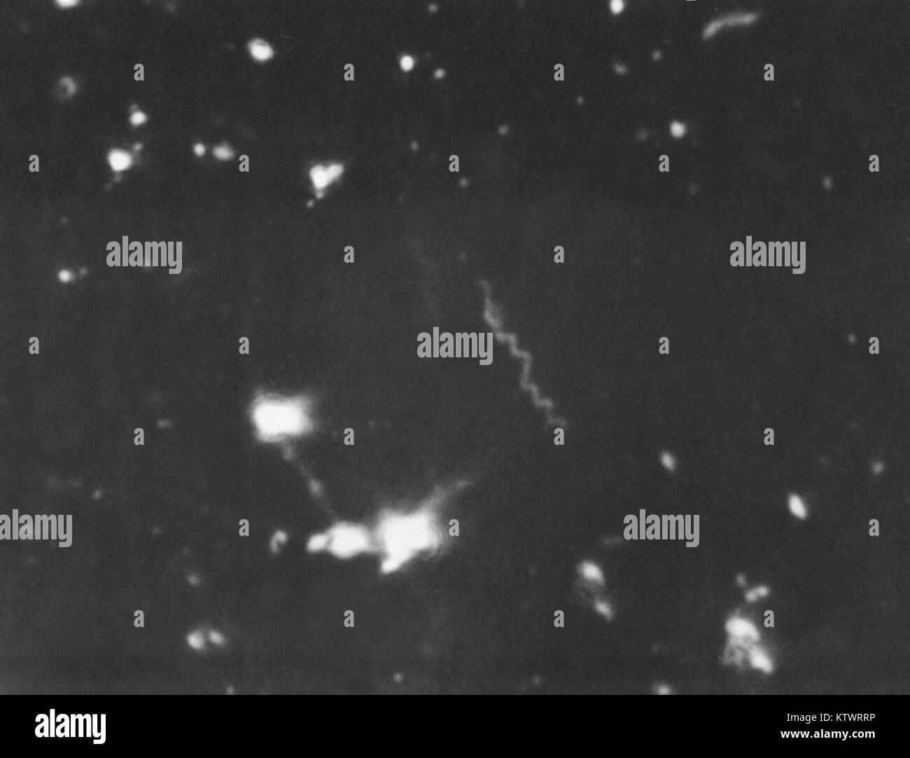 Treponema pallidum dark High Resolution Stock Photography and Images ...