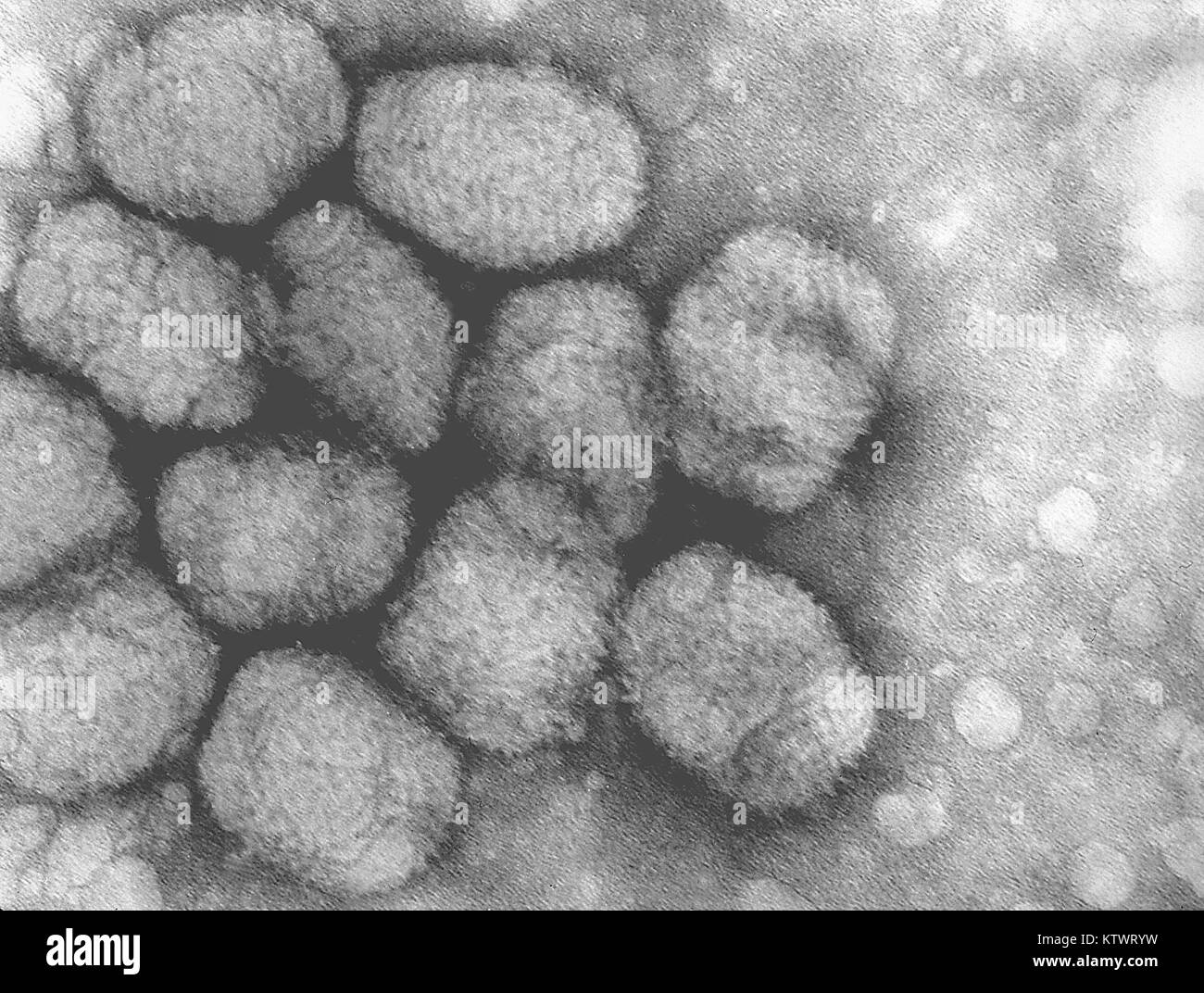 A transmission electron micrograph (TEM) of smallpox virus particles ...