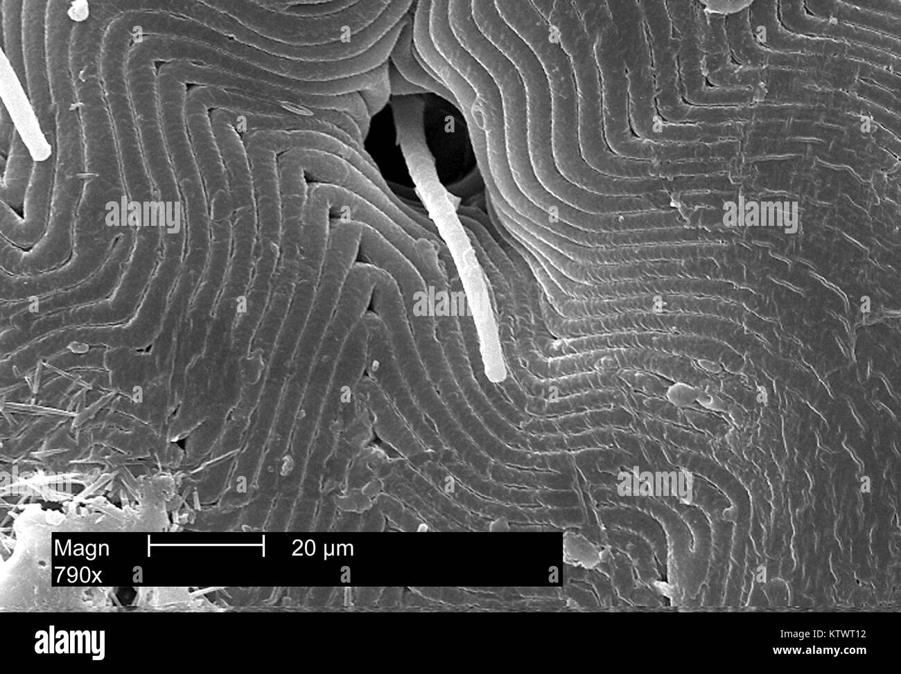 This scanning electron micrograph (SEM) depicts a dorsal view of the ...