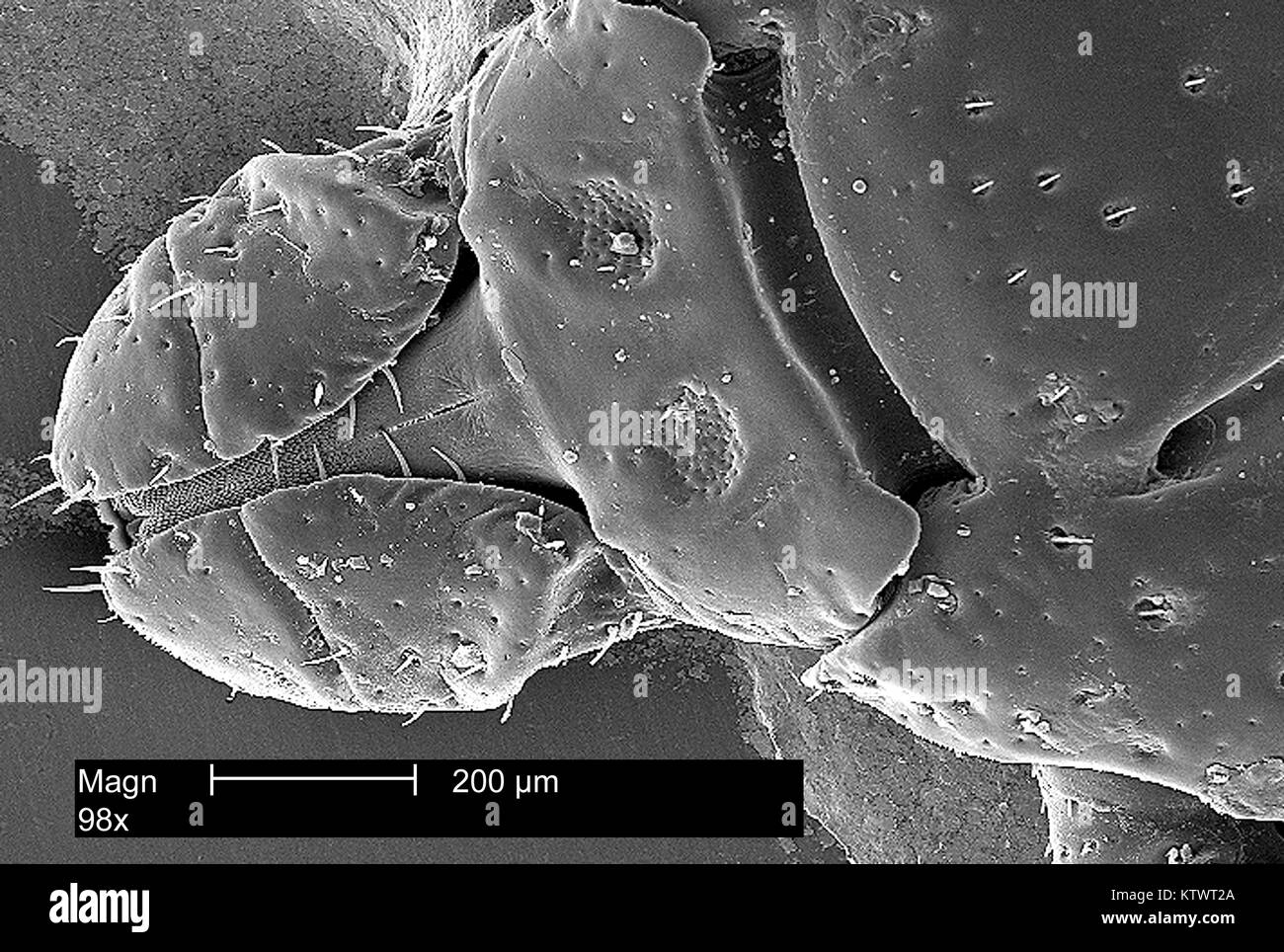 This scanning electron micrograph (SEM) depicts the dorsal view of the ...