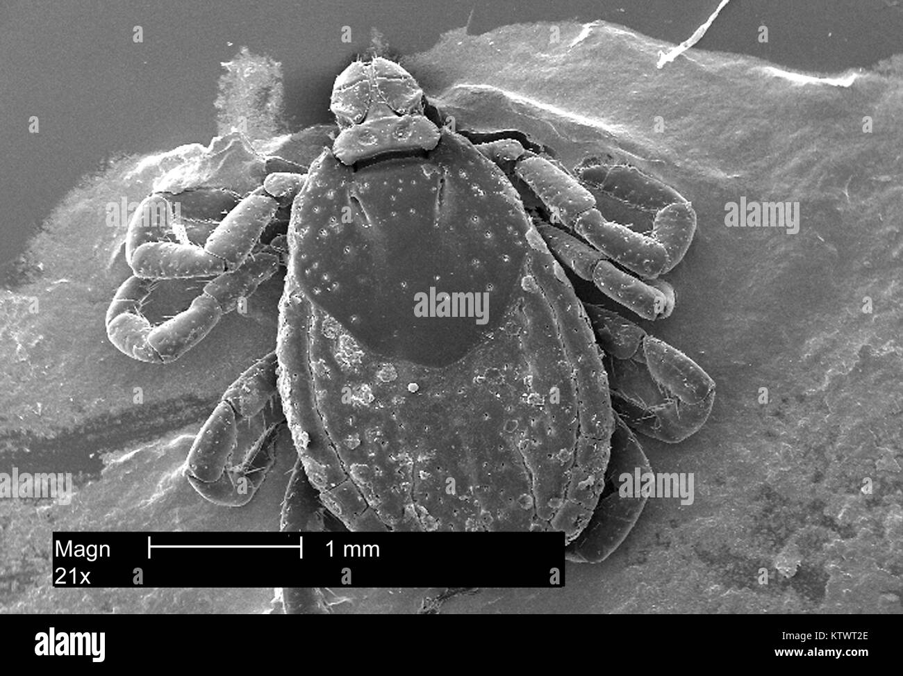 This scanning electron micrograph (SEM) presents a dorsal view of an ...