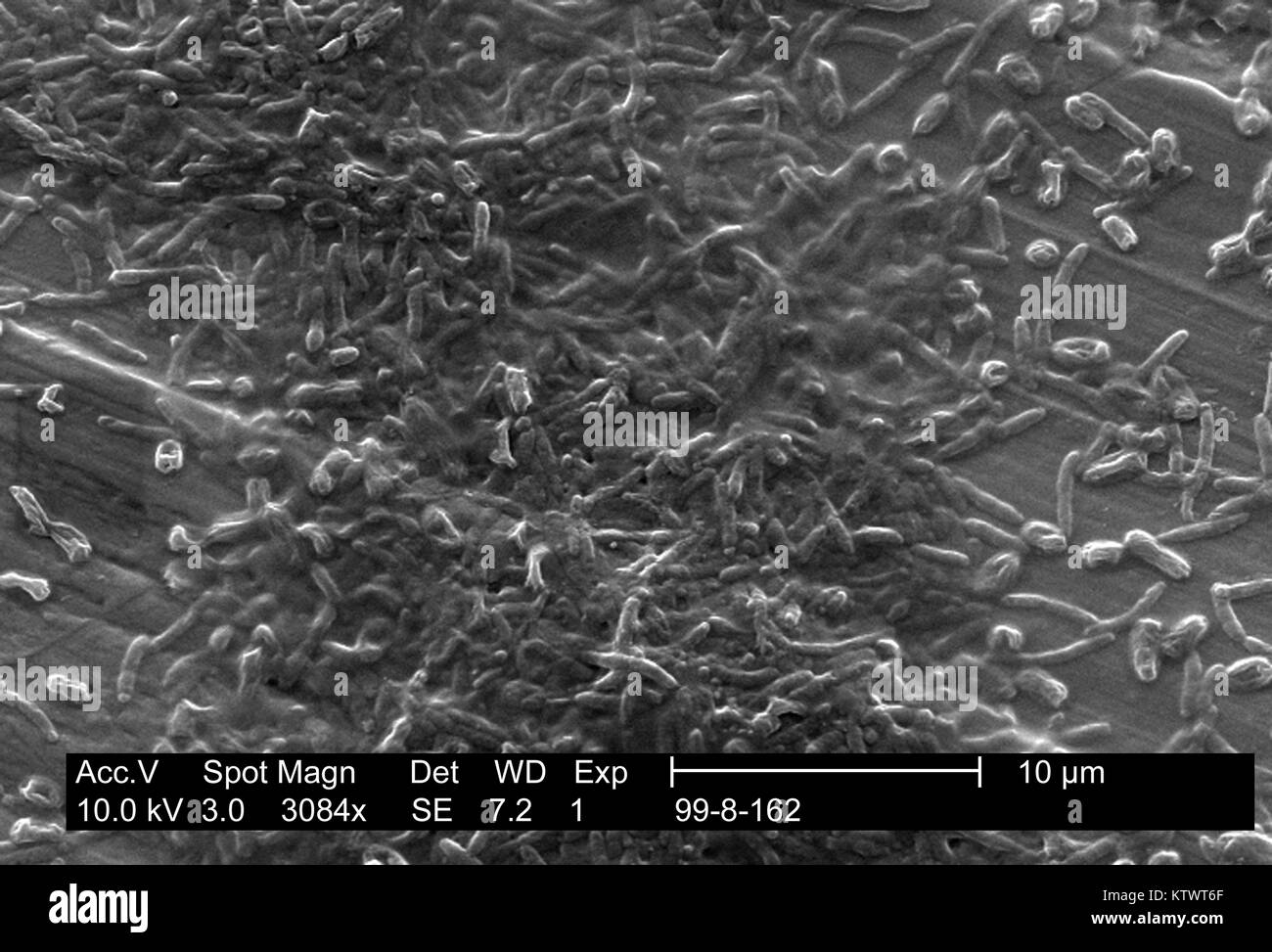 Hair Follicle Bacteria Sem