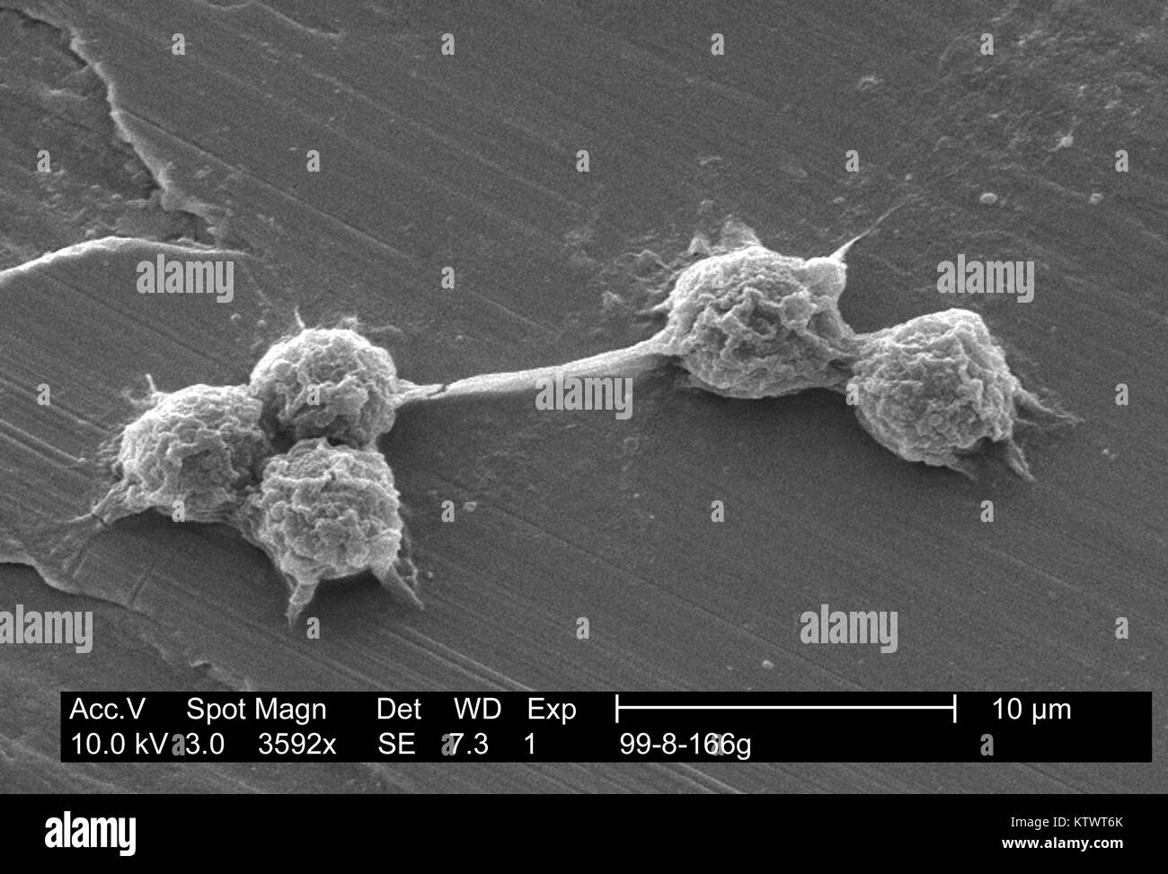Vesicles In A Cell Micrograph
