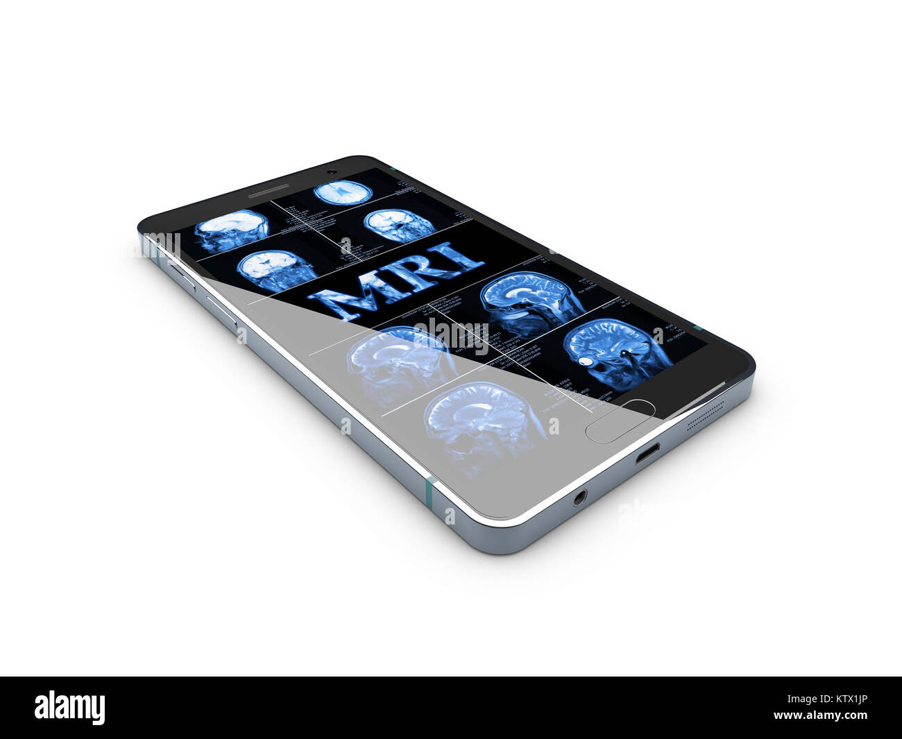Medicine concept: Smartphone with blue text MRI and X-ray of the skull ...