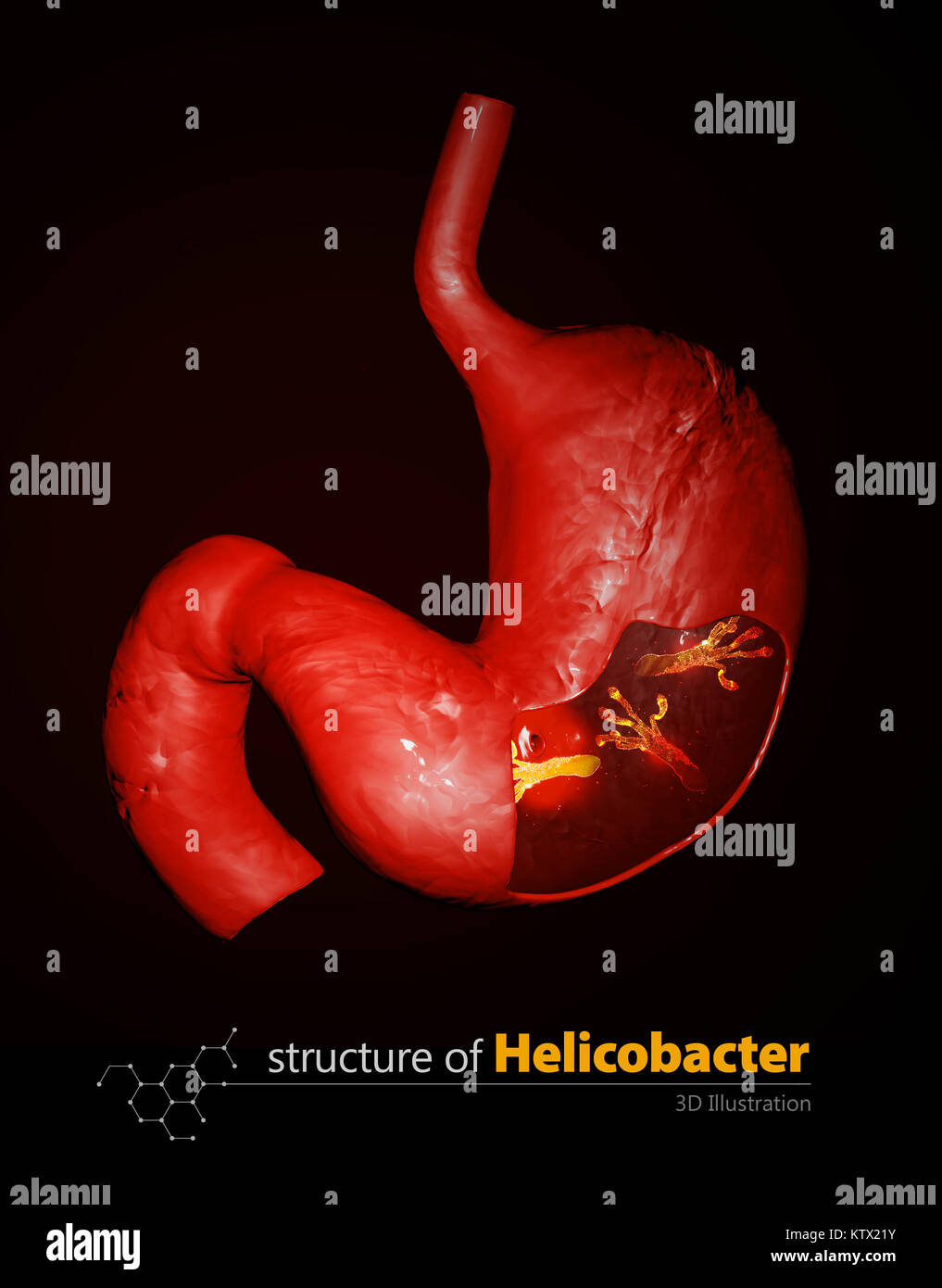 Helicobacter pylori stomach hi-res stock photography and images - Alamy