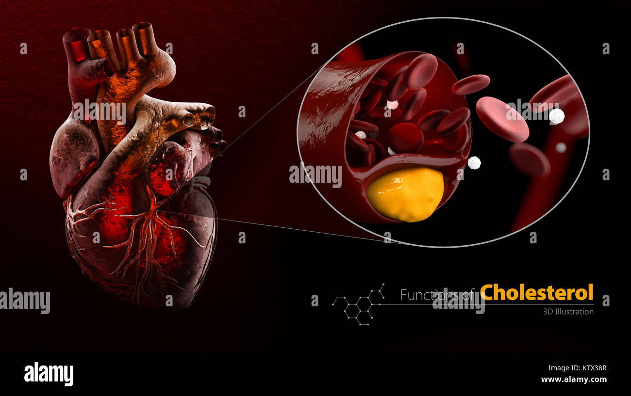 Hypercholesterolemia High Resolution Stock Photography and Images - Alamy