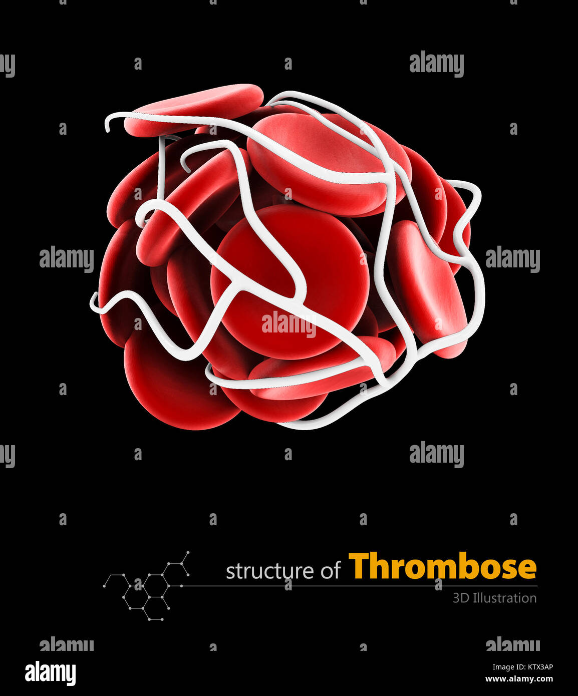 Blood clot and thrombosis medical 3d illustration concept. isolated ...