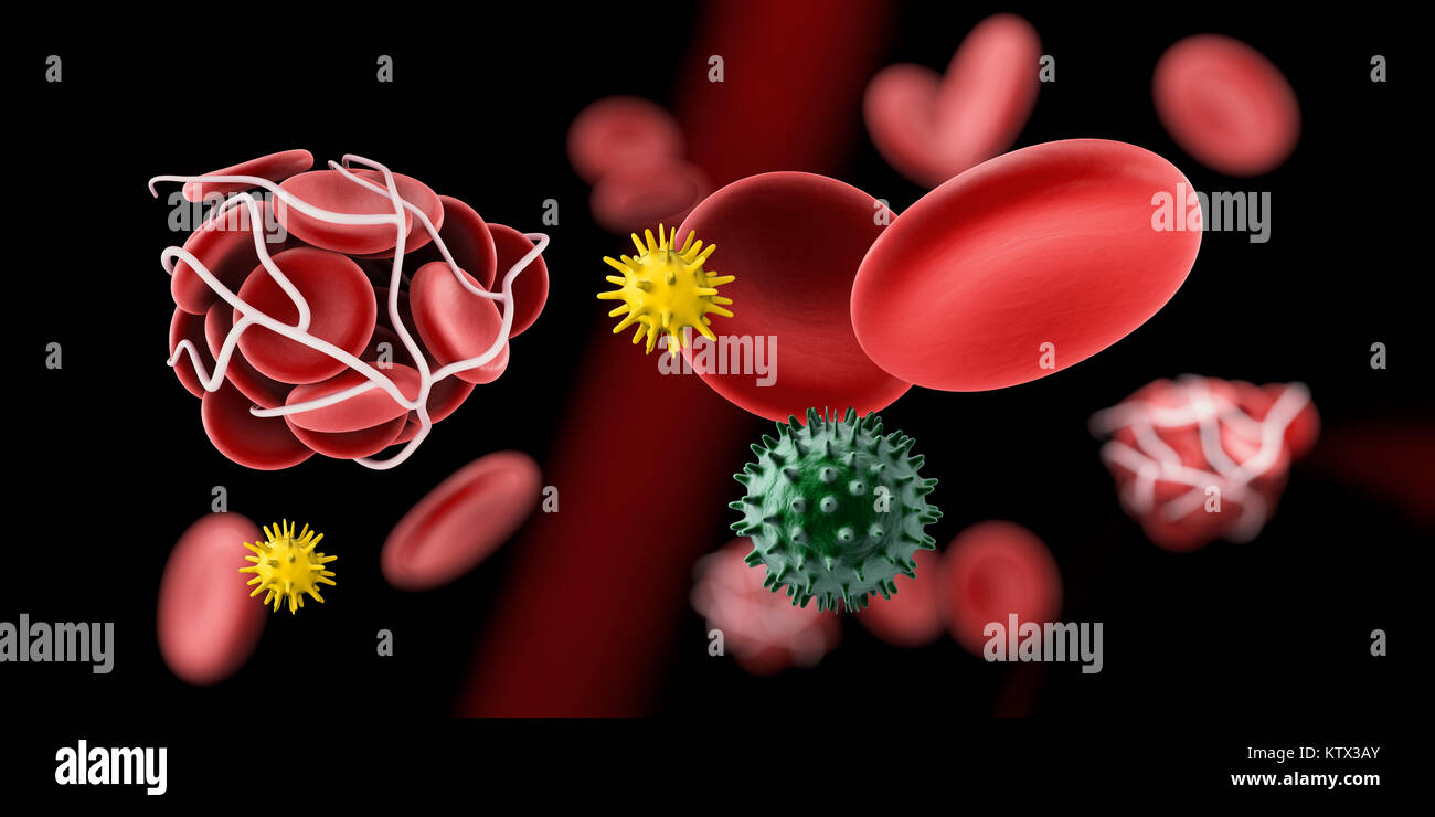 Blood clot and thrombosis medical 3d illustration concept Stock Photo ...