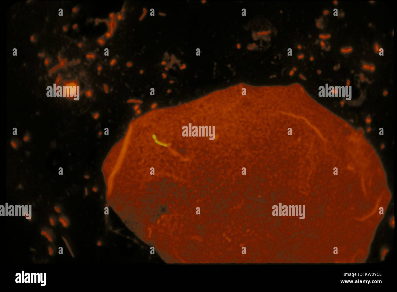 Fluorescent auramine hi-res stock photography and images - Alamy