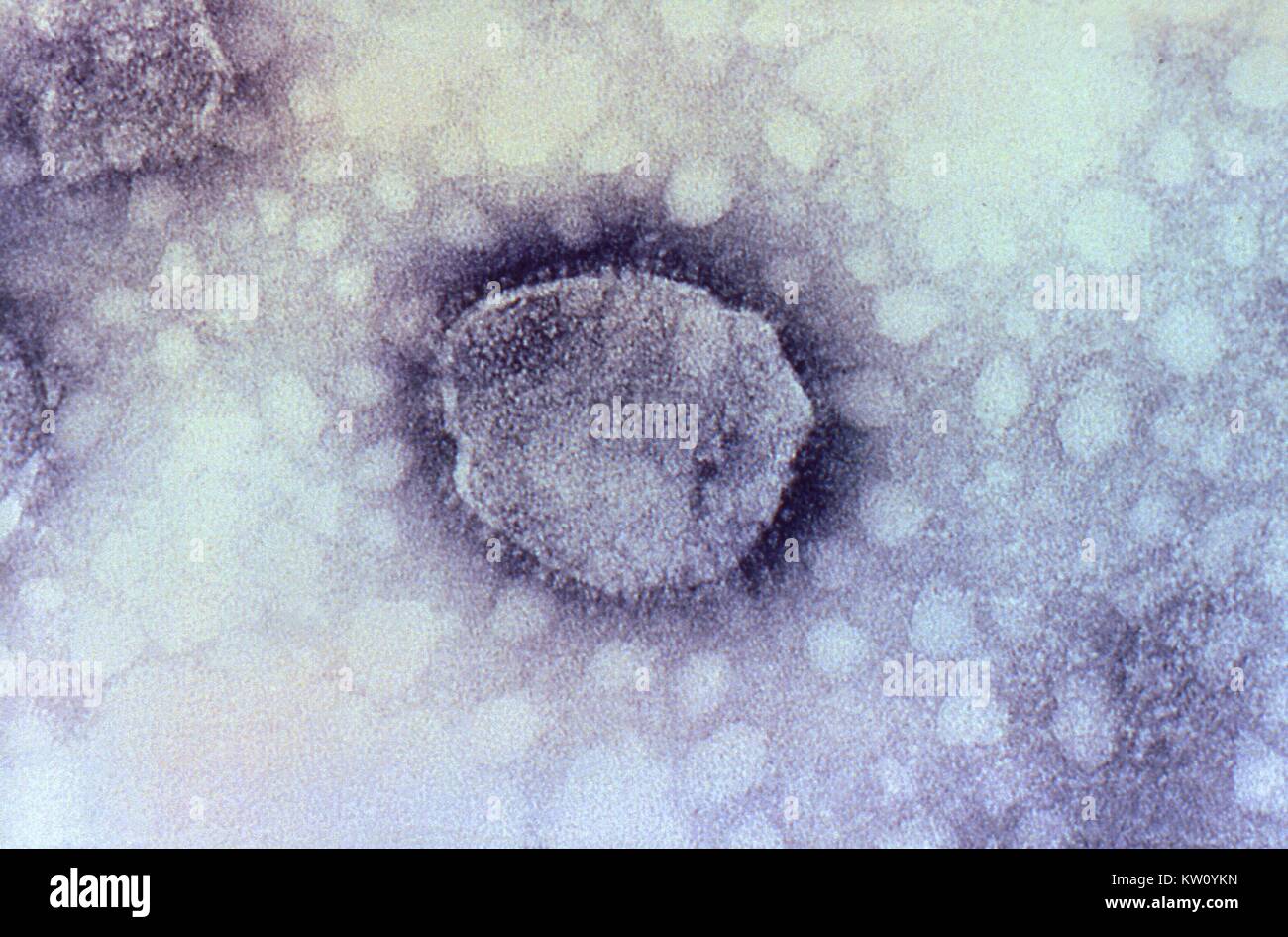 New world arenaviruses hi-res stock photography and images - Alamy