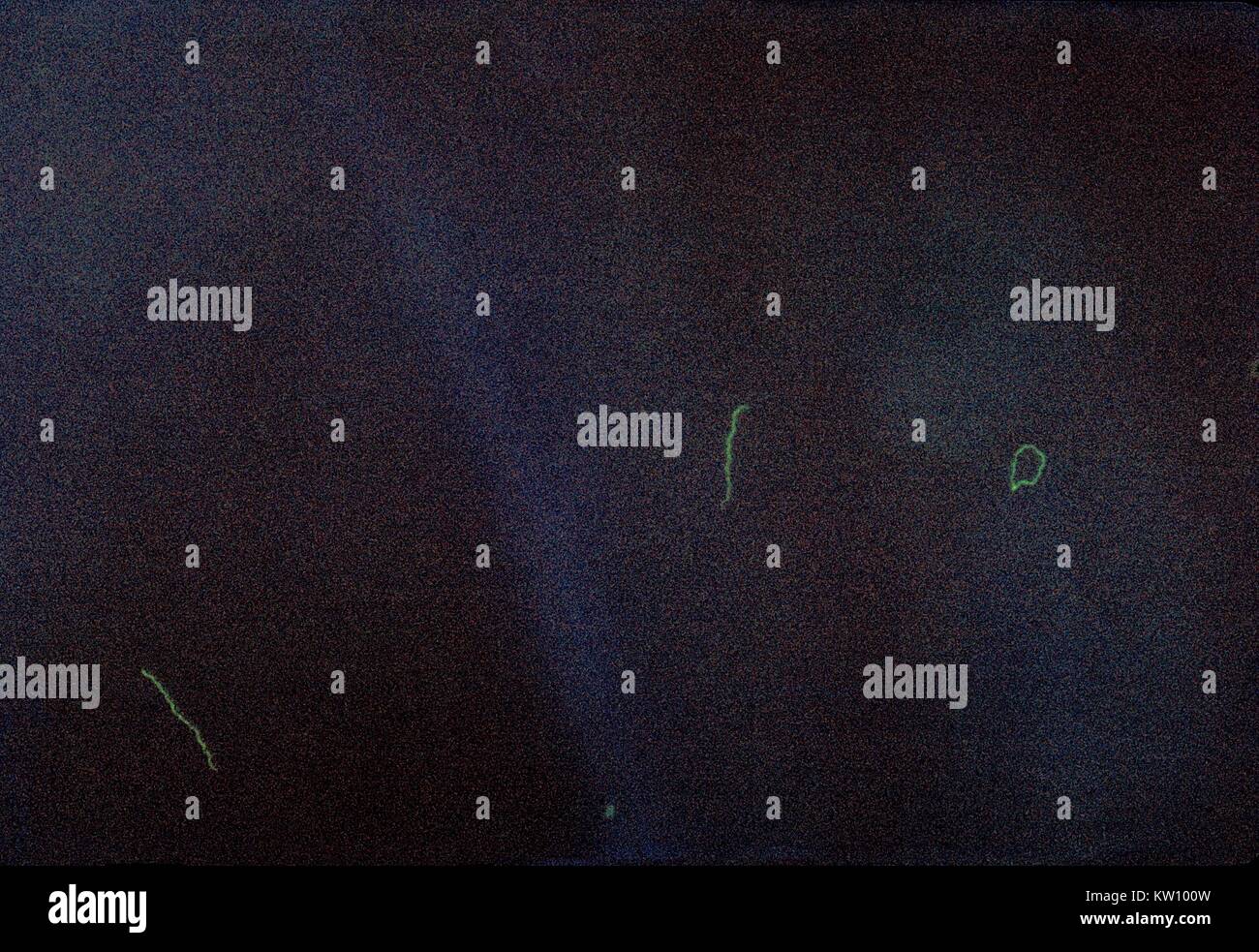 Treponema pallidum hi-res stock photography and images - Alamy