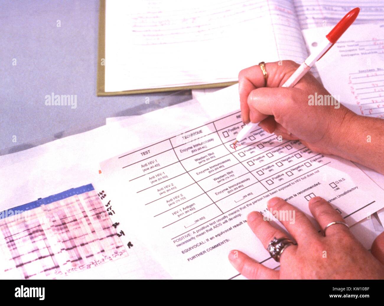 Here a CDC lab technician is filling out an AIDS diagnostic report ...